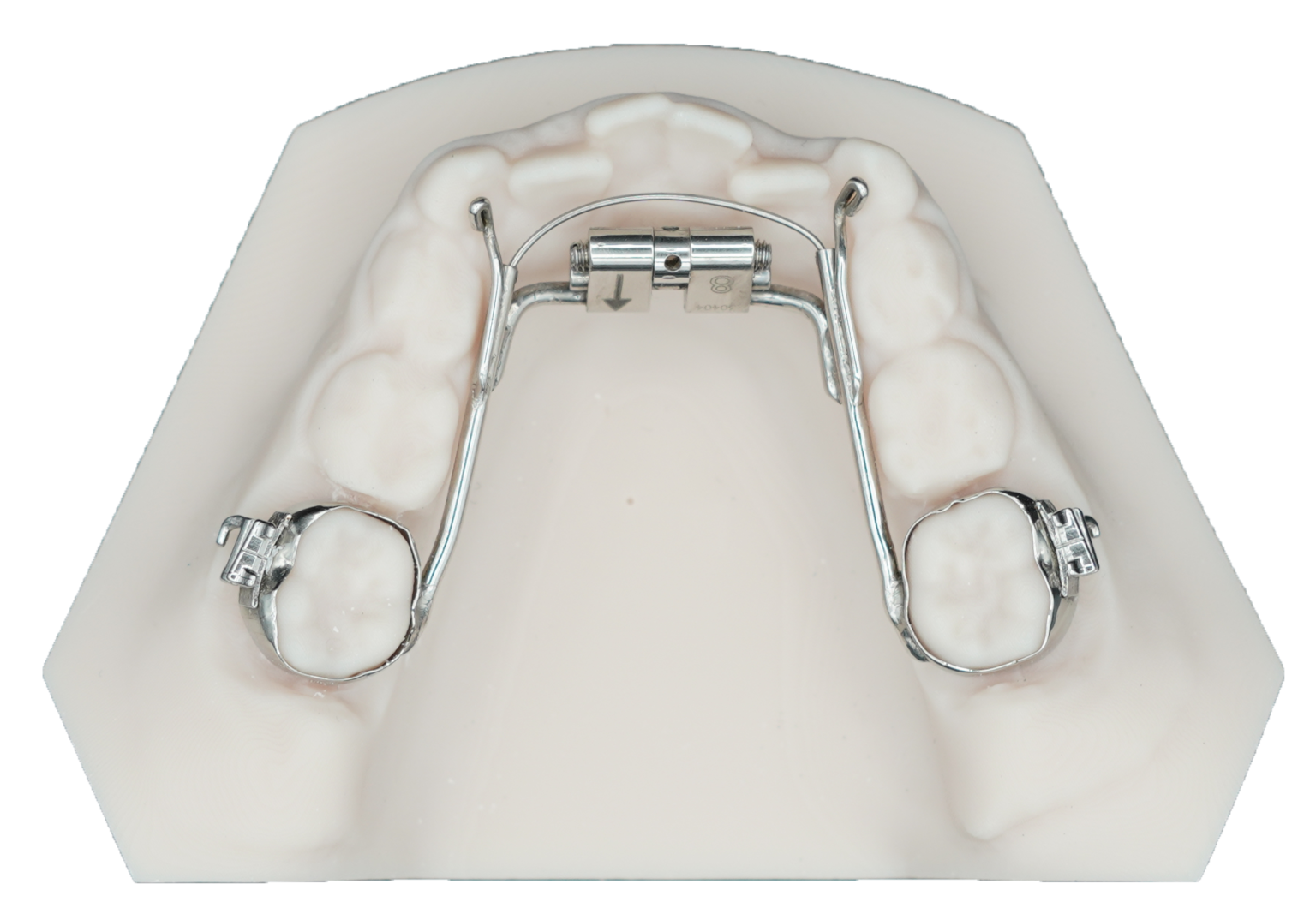 Lower Williams Expander - Protec Dental