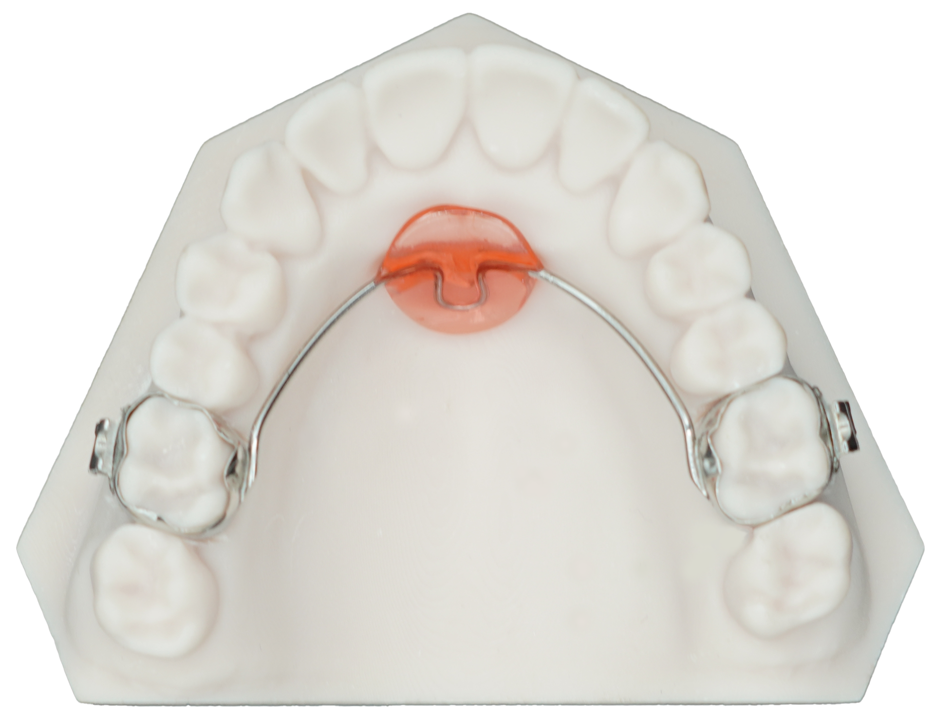 Nance Protec Dental Nance Protec Dental