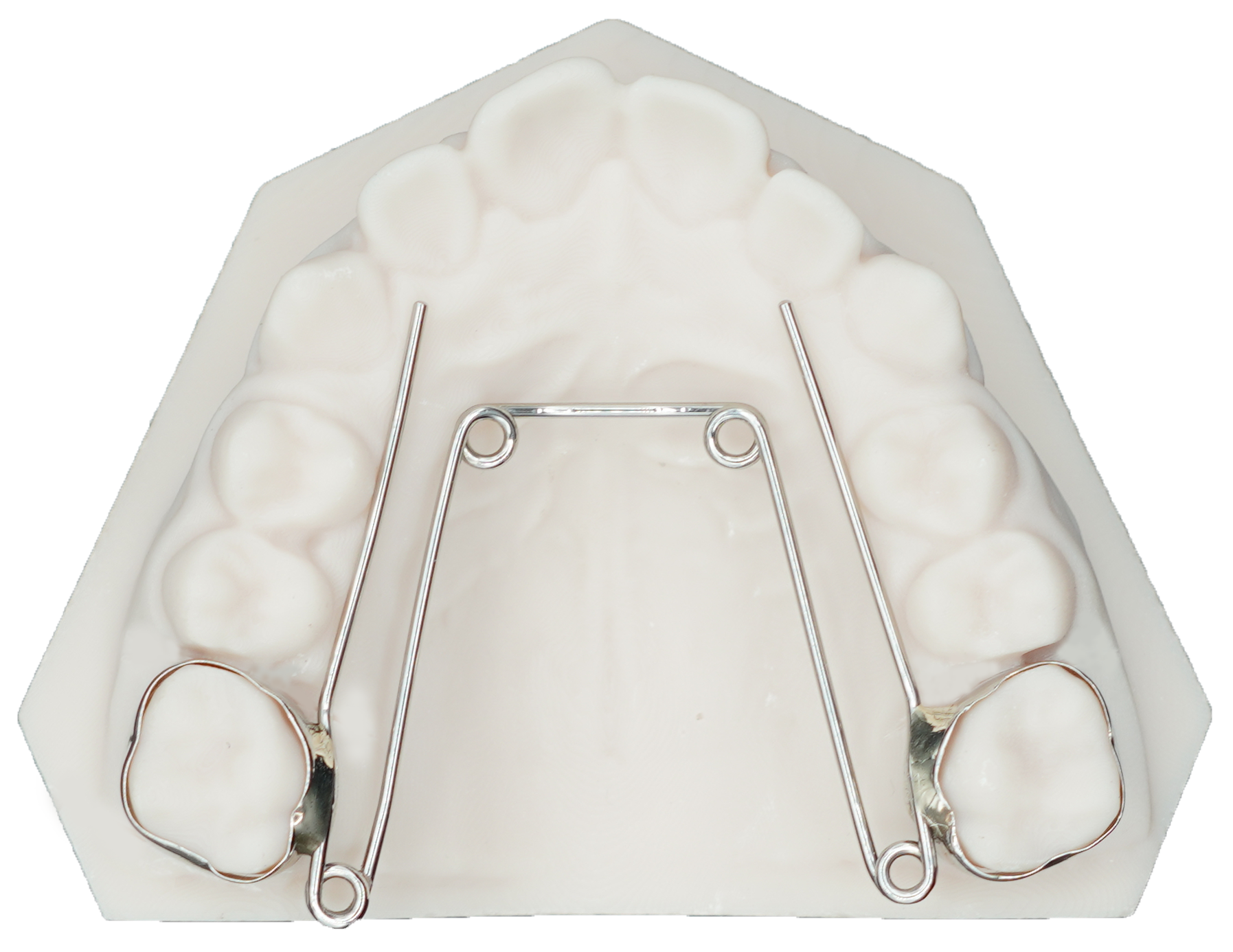 Quad Helix Appliance
