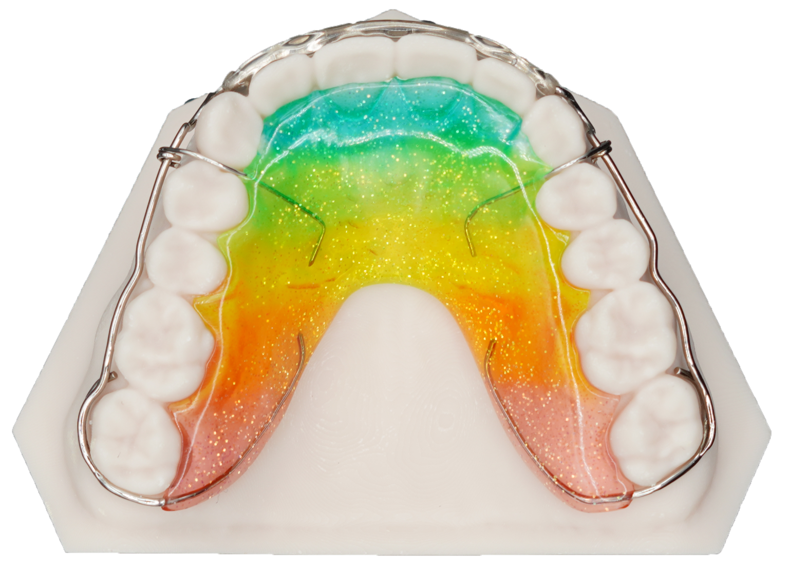 Wrap Around Retainer (Acrylic Bow) - Protec Dental