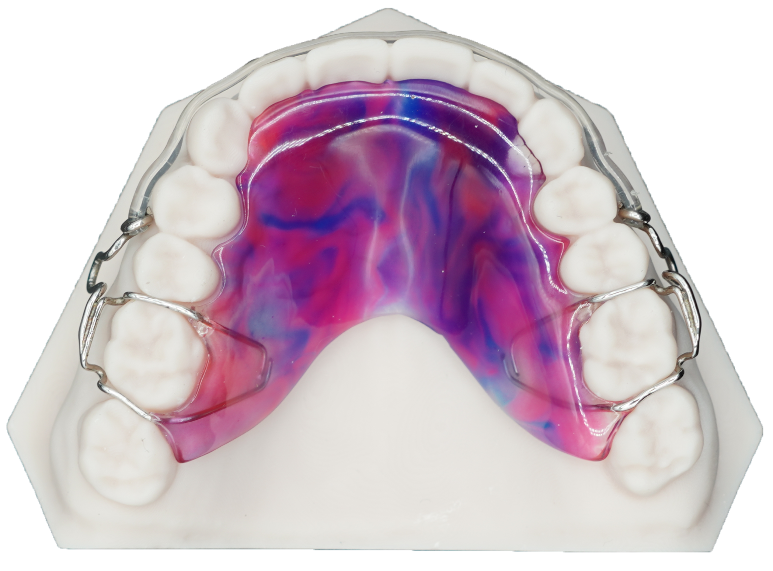 ClearBow Retainer - Protec Dental