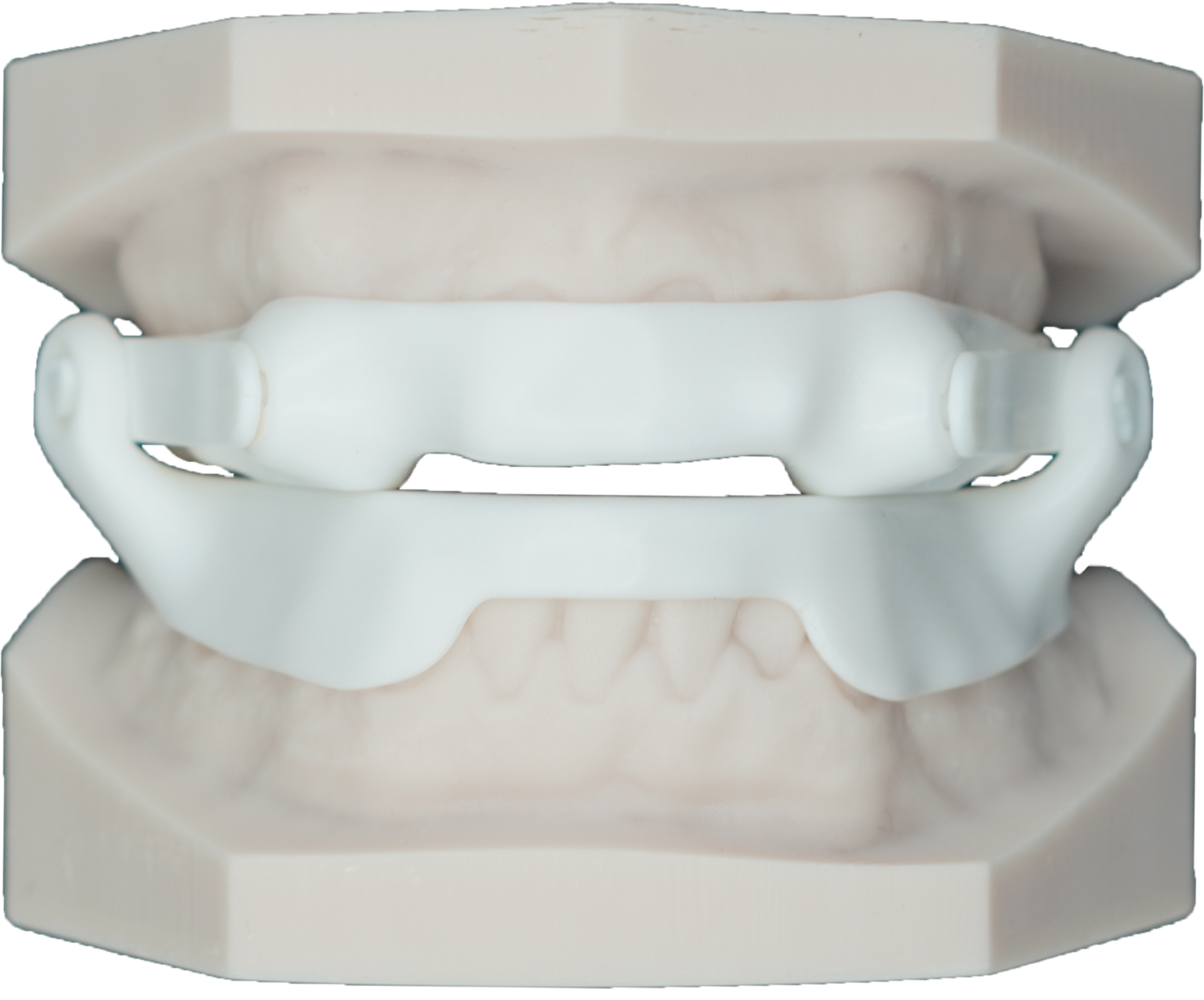 D-SAD Sleep Apnea Device - Protec Dental