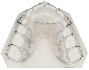 Removable Tongue Thrust Appliance - Protec Dental